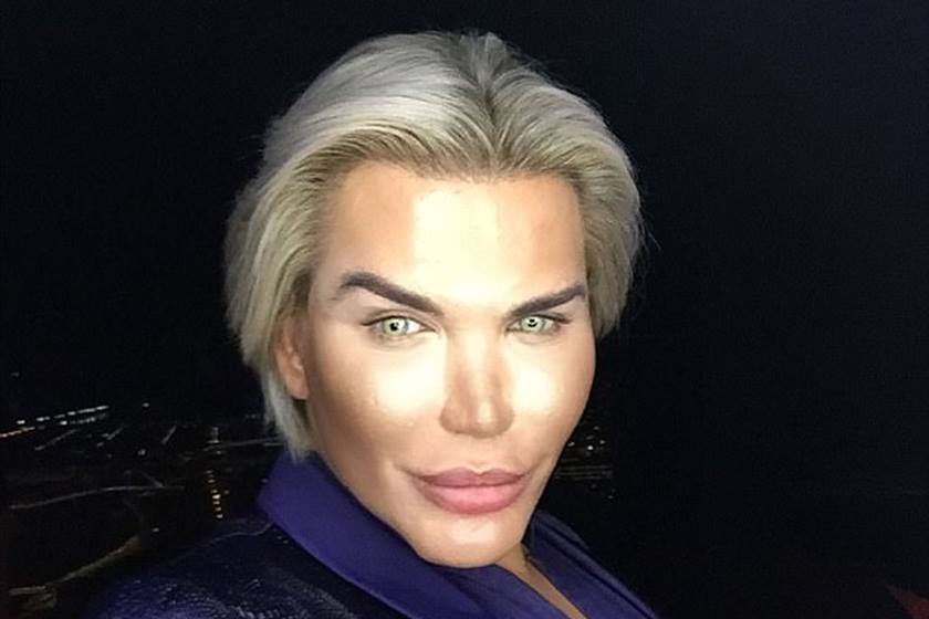 Ken Humano revela o que fez com costelas que retirou para ficar magro | Metrópoles