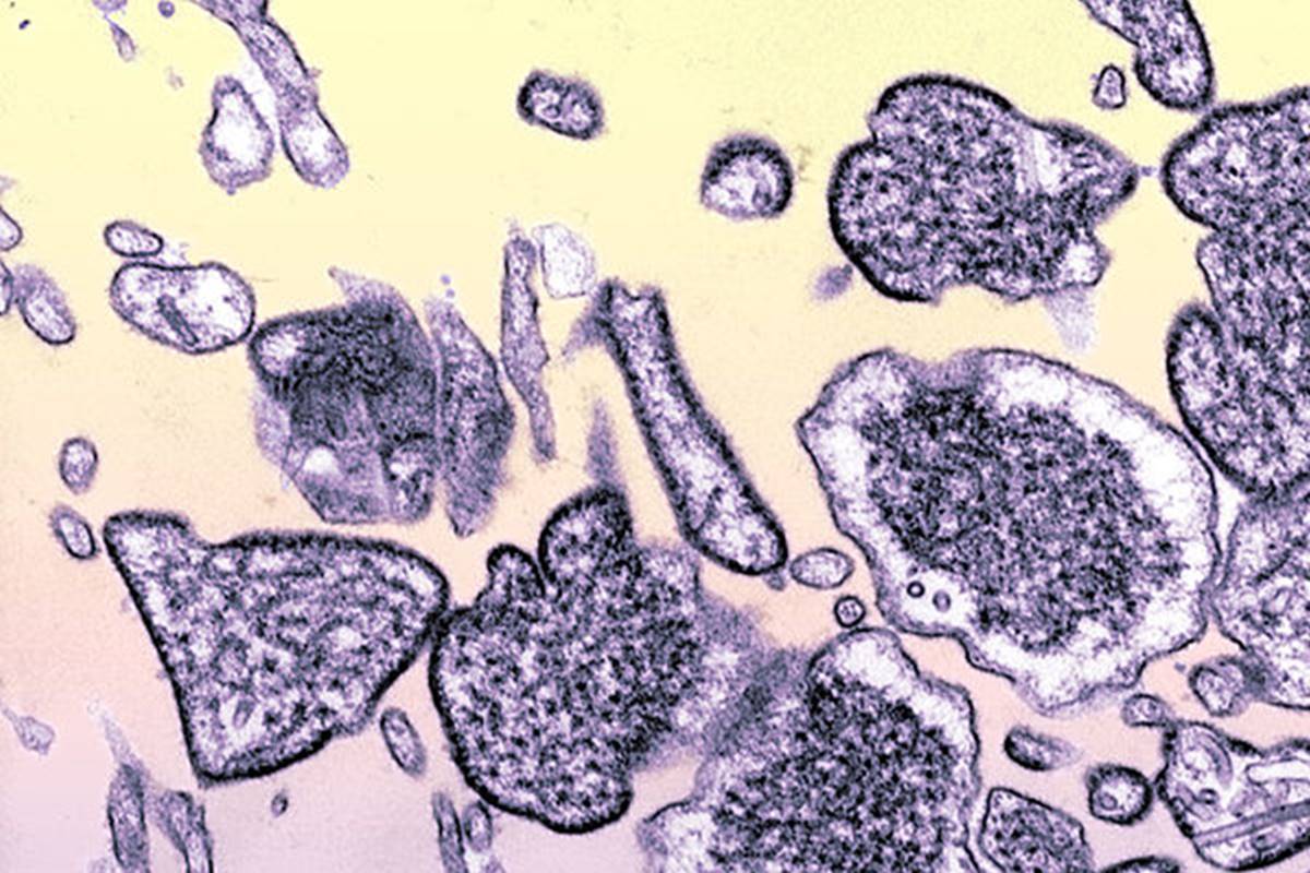Nipah: entenda por que vírus em surto na Índia tem potencial pandêmico ...