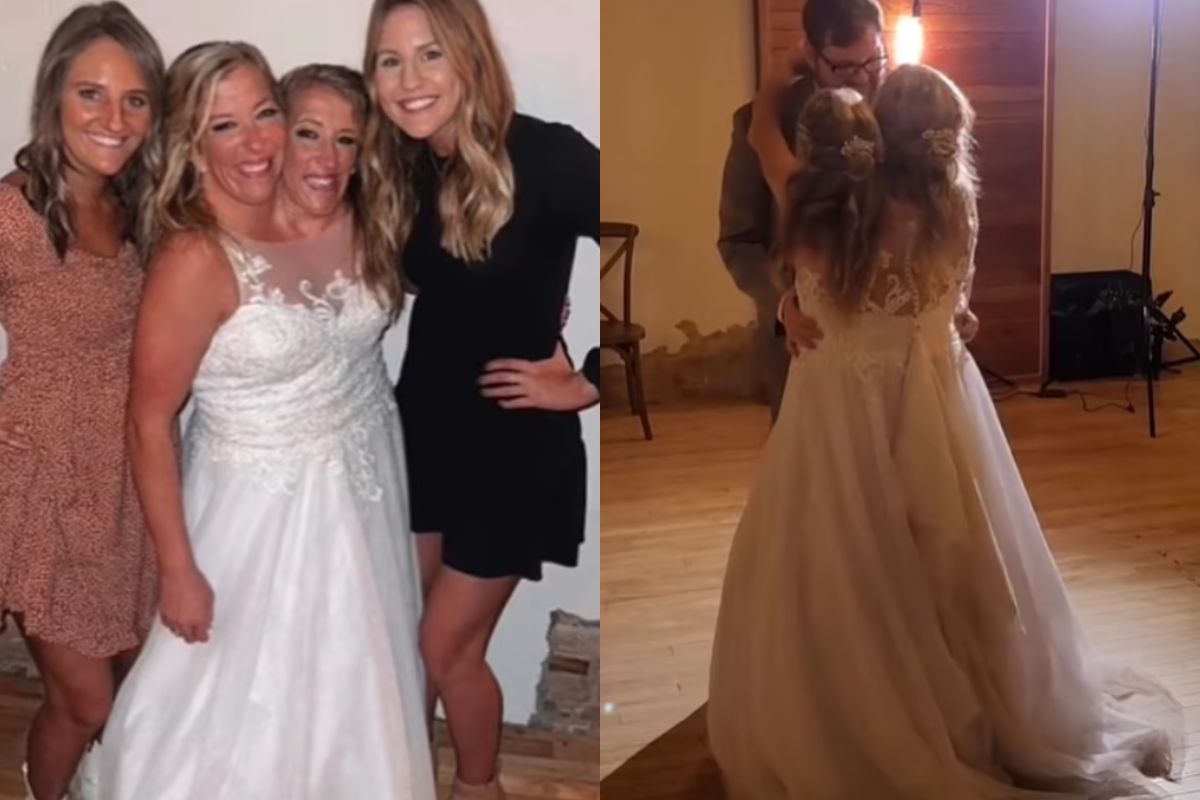 Gêmea siamesa se casa, mesmo vivendo unida à irmã | Metrópoles