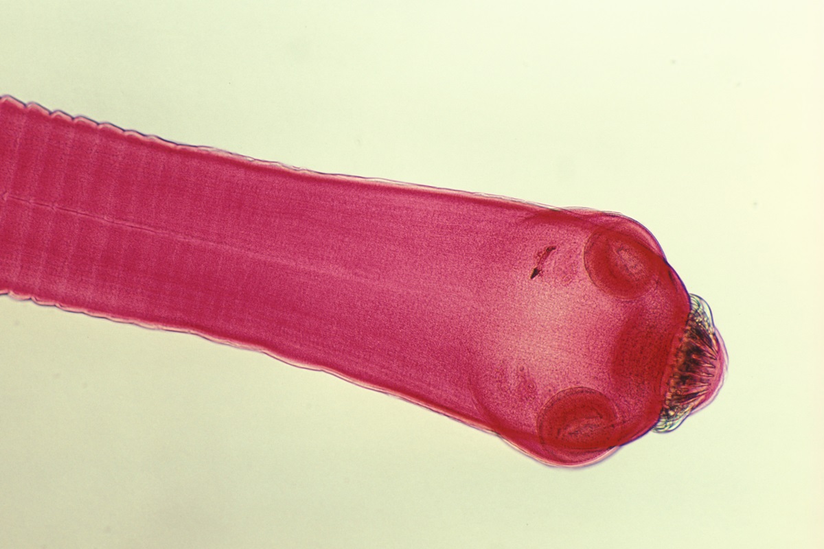 Homem é infectado com tênia após comer bacon mal passado | Metrópoles